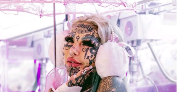 Nyaris Buta Akibat Mentato Bola Mata