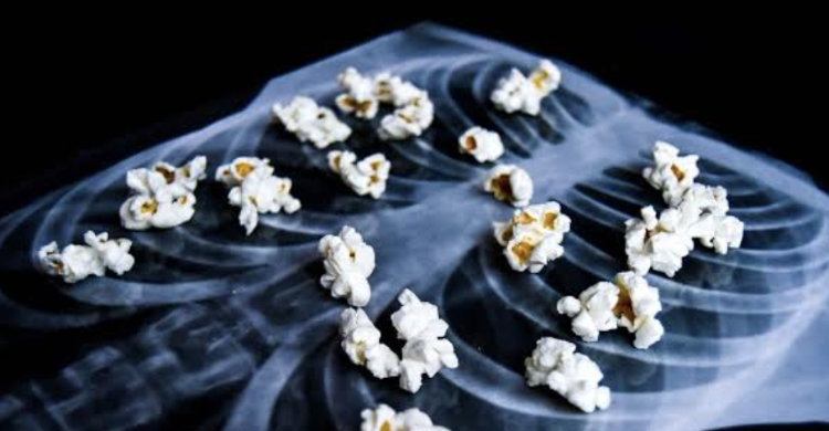 Waspada Popcorn Lung, Infeksi Paru-Paru Akibat Rokok Elektrik