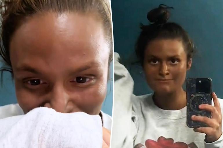 Ketiduran 8 Jam, Wajahnya Gosong