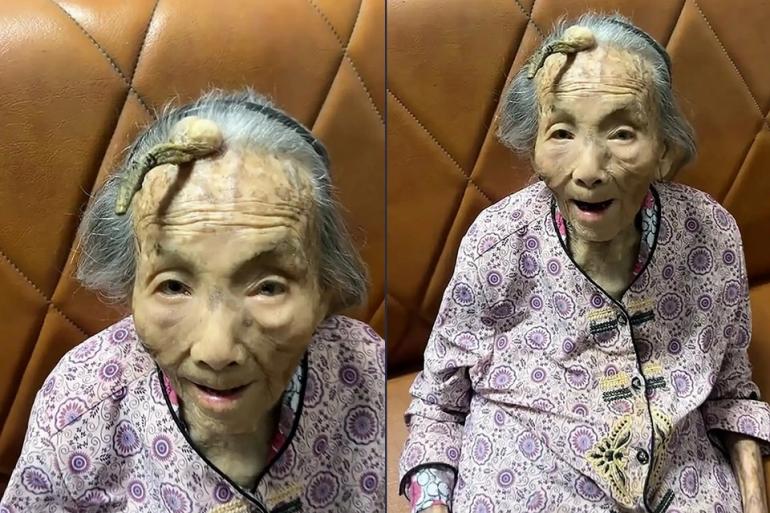 Nenek Punya Tanduk Di Jidat